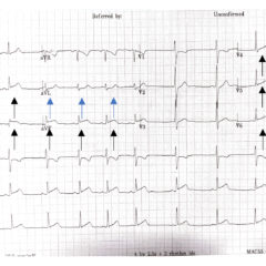 Clinical Evaluation and Management of Pediatric Pericarditis - JETem
