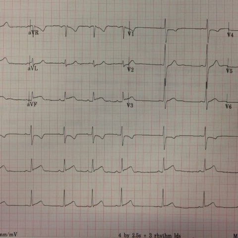 Clinical Evaluation and Management of Pediatric Pericarditis - JETem