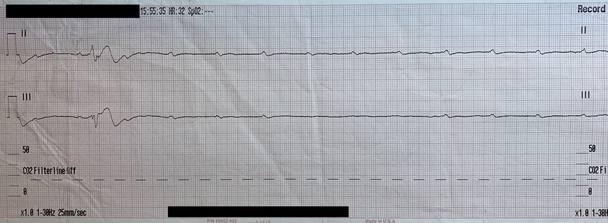 PVSS EKG 1, Field. PVSS EKG 3, ED. JETem 2020 - JETem