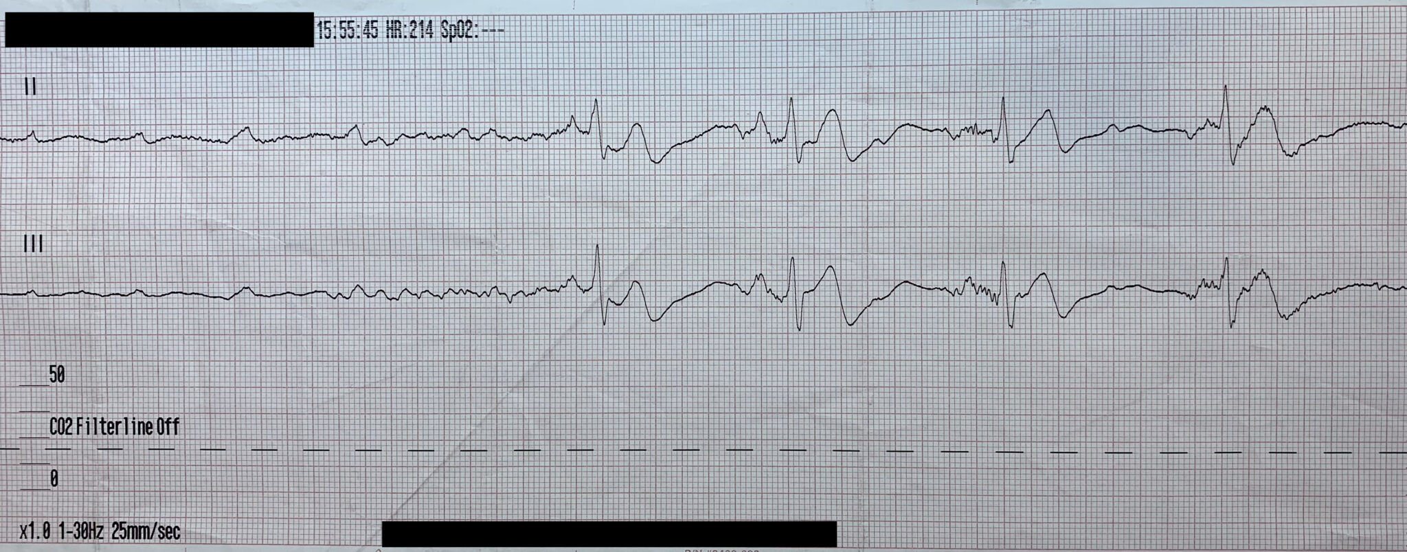 PVSS EKG 2, Field. PVSS EKG 3, ED. JETem 2020 - JETem