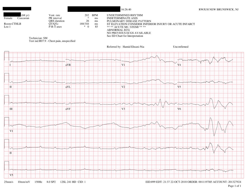PVSS EKG 3, ED. JETem 2020 - JETem