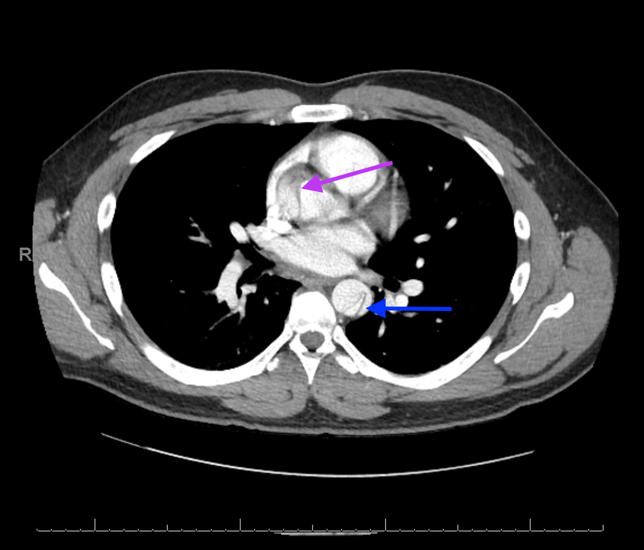 TAA. CT 2. Annotated. JETem 2021 - JETem